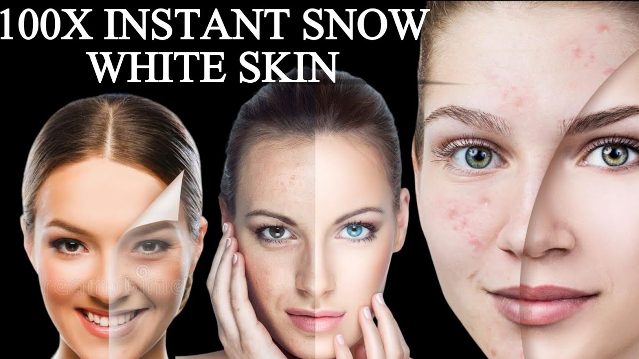 ⚠️ 100X POWERFUL INSTANT SNOW WHITE SKIN REMOVED WRINKLE MELASMA HYPER ...