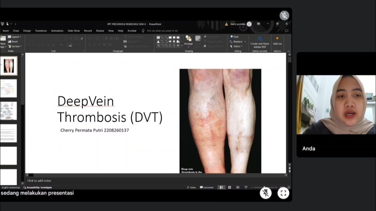 Tugas Cardiology 2208260137 Cherry Permata Putri - YouTube