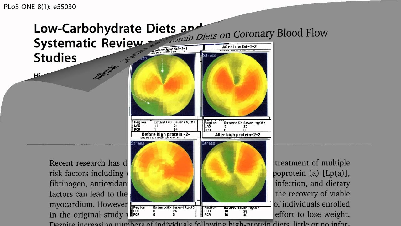 Diet for heart disease - Low carb, food antioxidants and heart disease ...