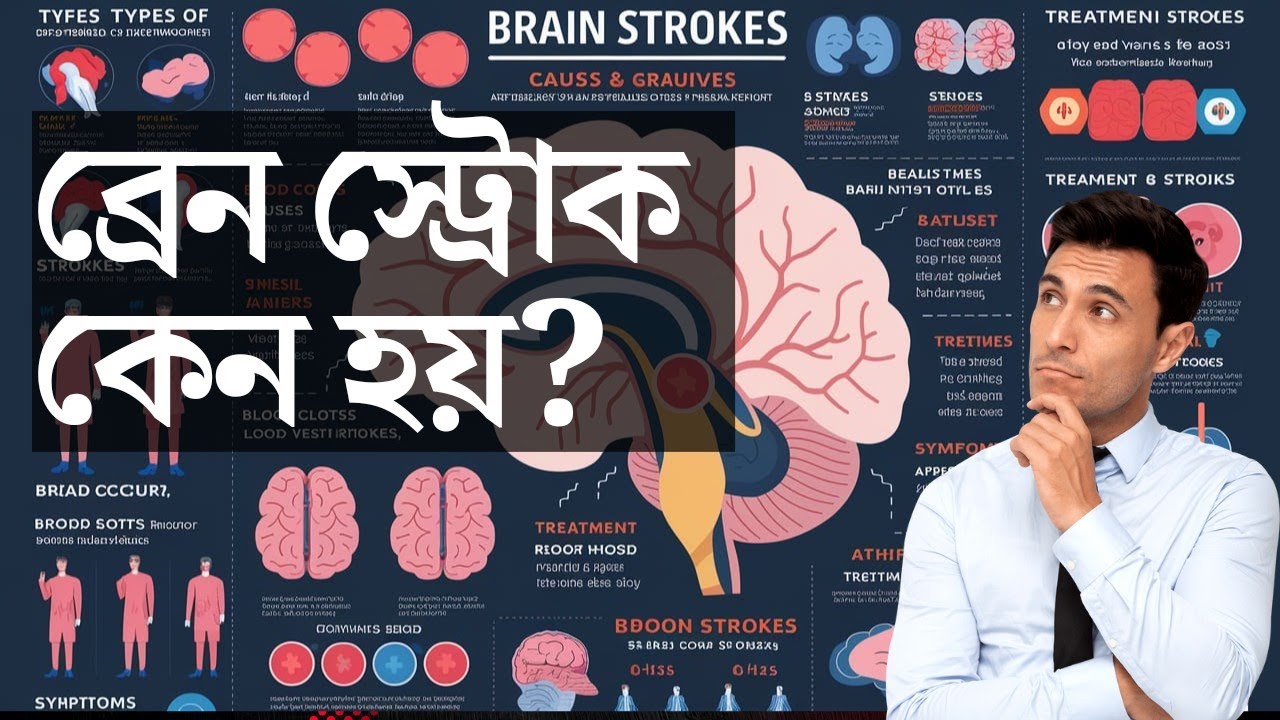 Brain Stroke, Types of, Causes, Pathology, Symptoms, Treatment and ...
