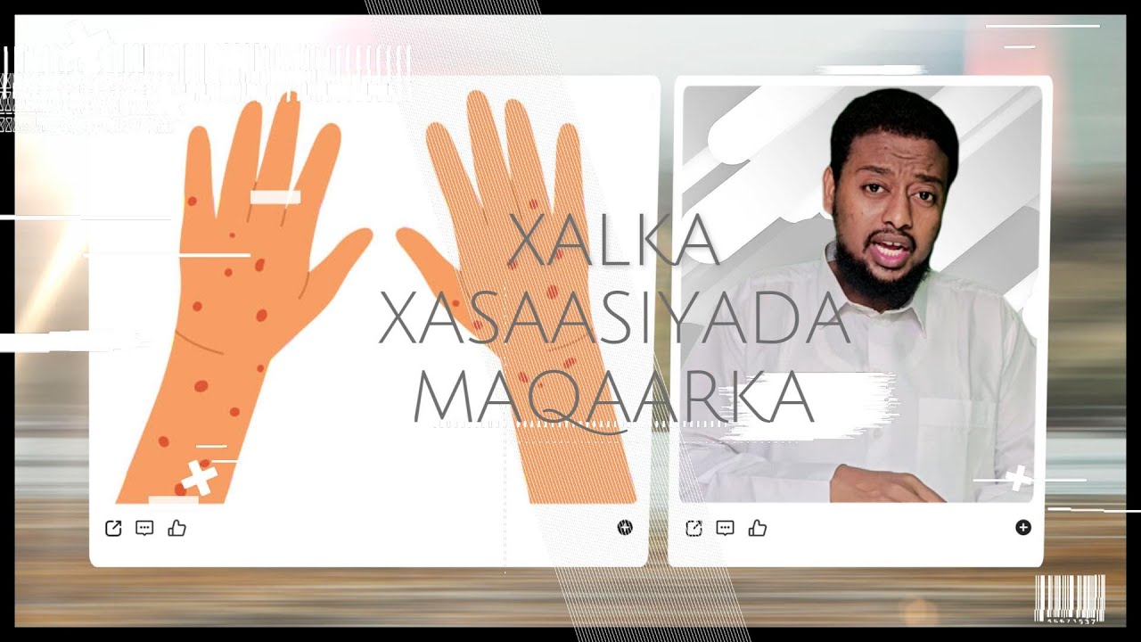 XALKA XASAASIYADA MAQAARKA | #herbalhealth #somalia #xamar #mogadishu # ...