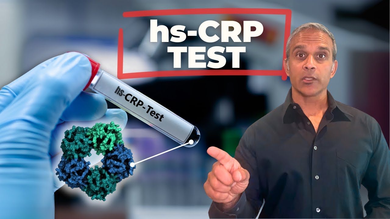 Heart Disease Prevention Starts With This Test - YouTube