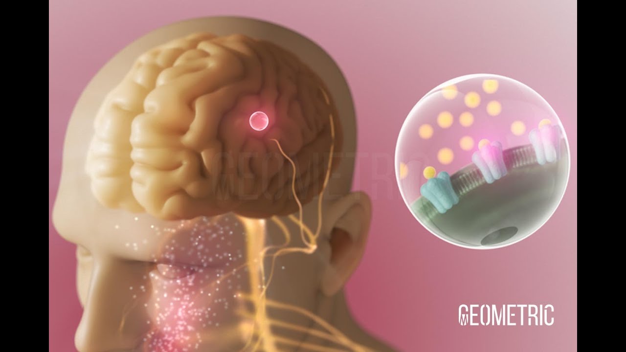 Breakthrough Cancer Pain (BTcP) Medical Animation by Geometric Medical ...