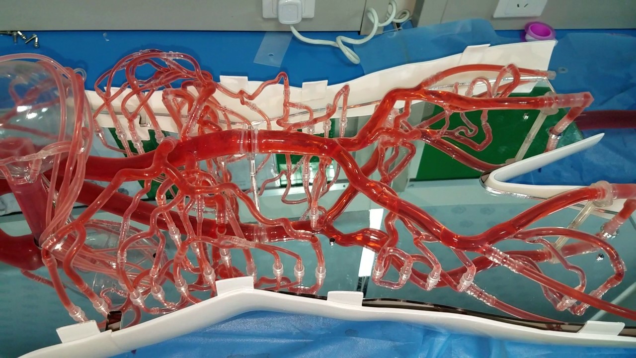 endo vascular simulation system from Trandomed 3D - YouTube