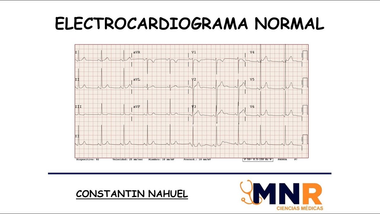 ELECTROCARDIOGRAMA NORMAL 2 2020 - YouTube
