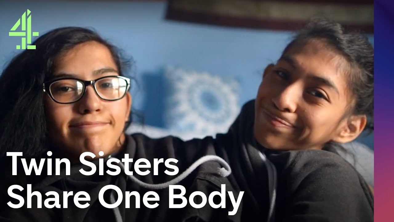Life as Teenage Conjoined Twins | Two Sisters, One Body | Channel 4 ...