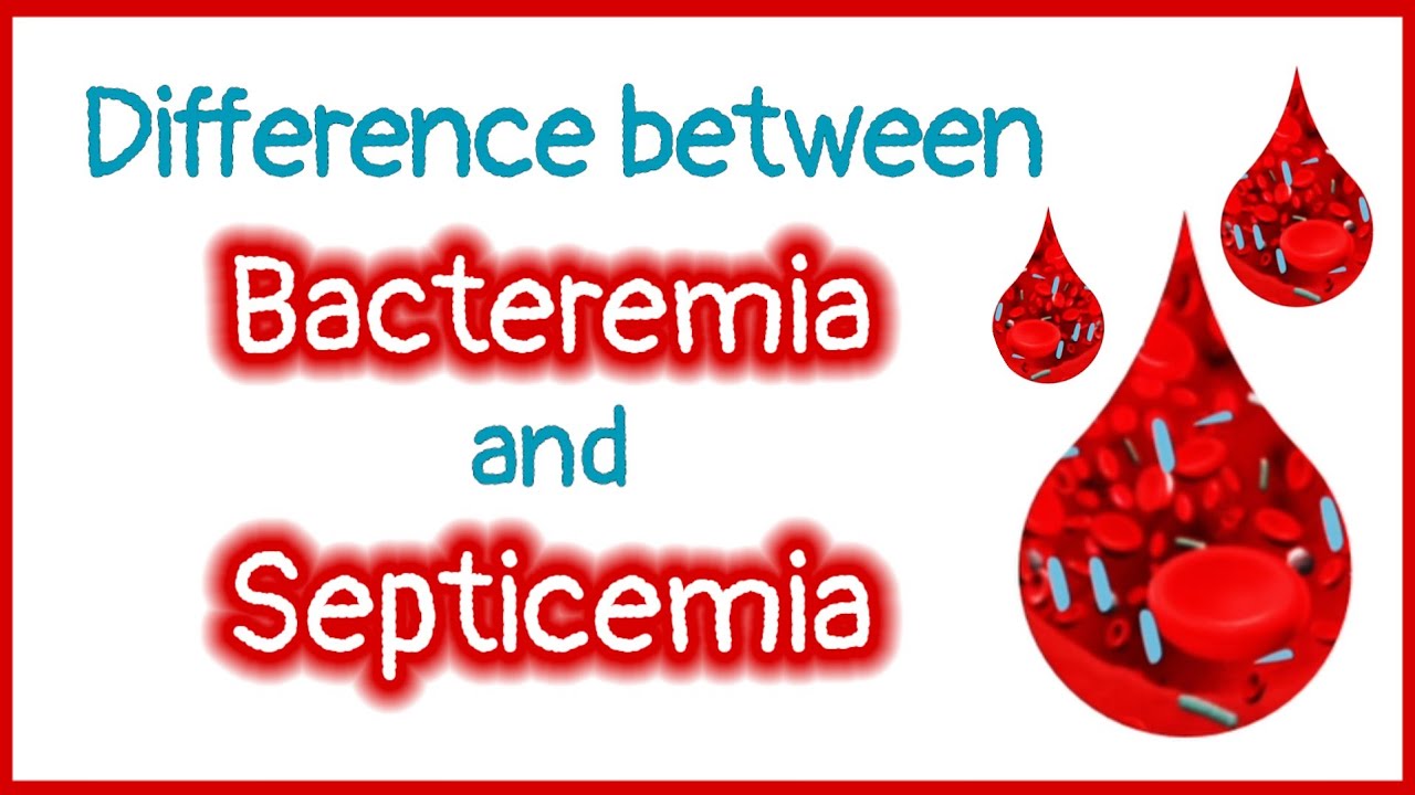Difference between bacteremia and septicemia|#microbiology#sepsis# ...