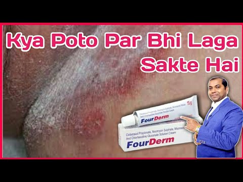 FourDerm Cream Kaha Aur Kaise Use Karen | FourDerm Ointment | FourDerm ...