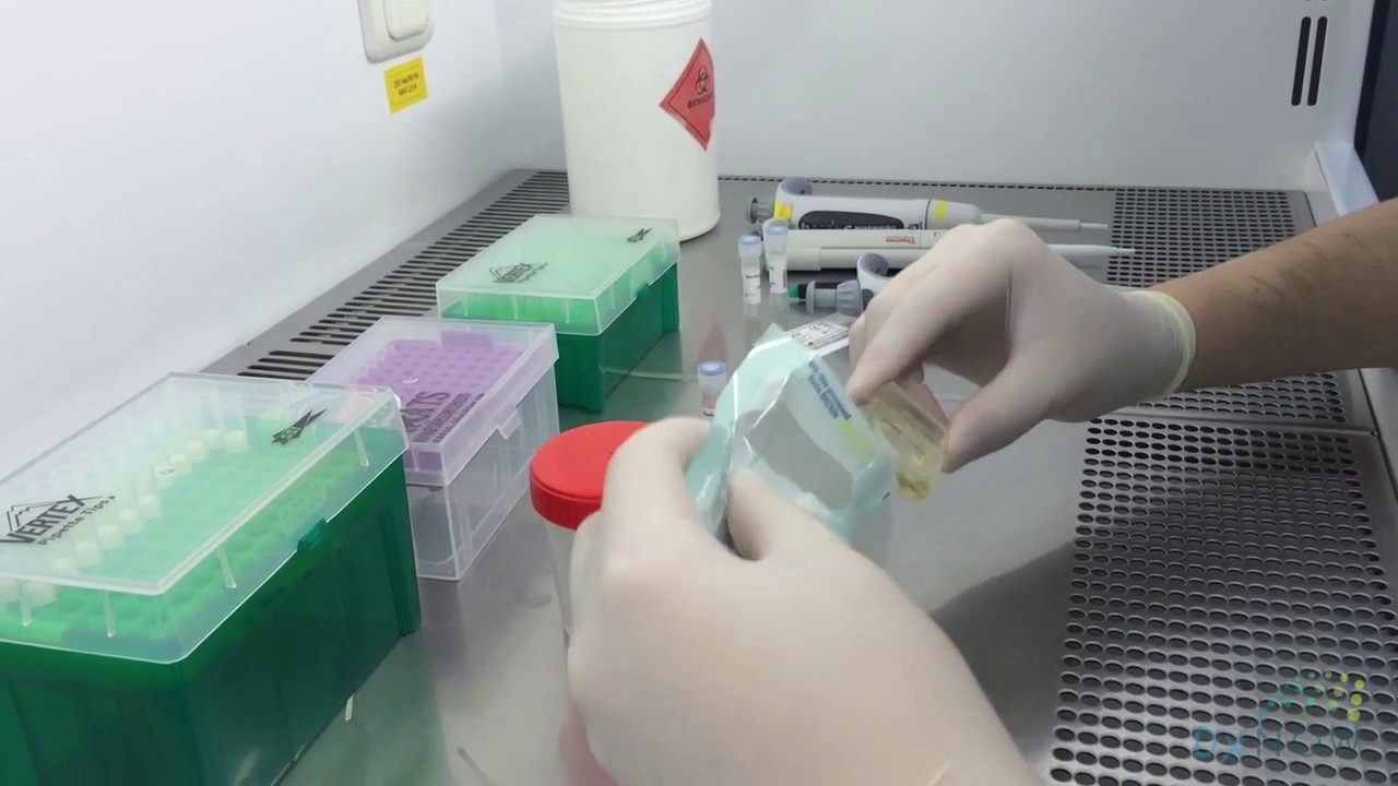 DxNow Training Video FERTILE PLUS™ Microfluidic Sperm Sorting Chip HD ...