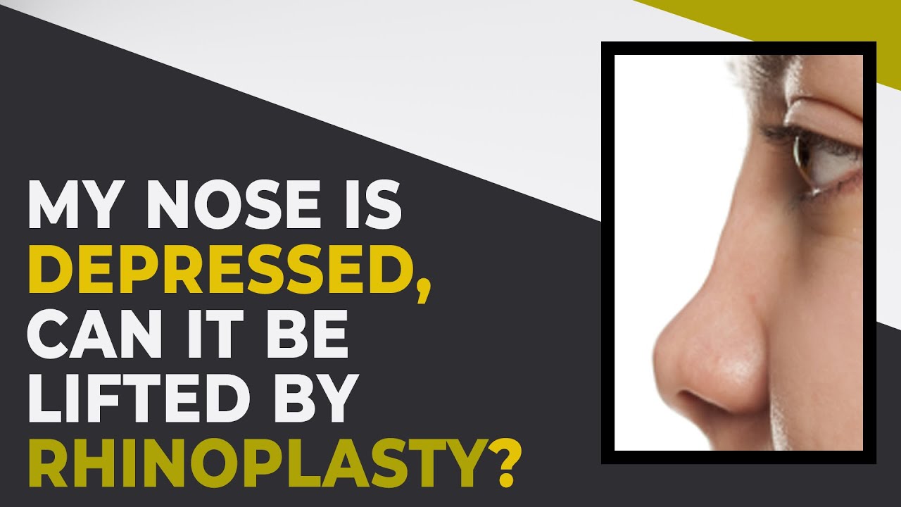My Nose is Depressed, Can it Be Lifted by Rhinoplasty? Nose job surgery ...