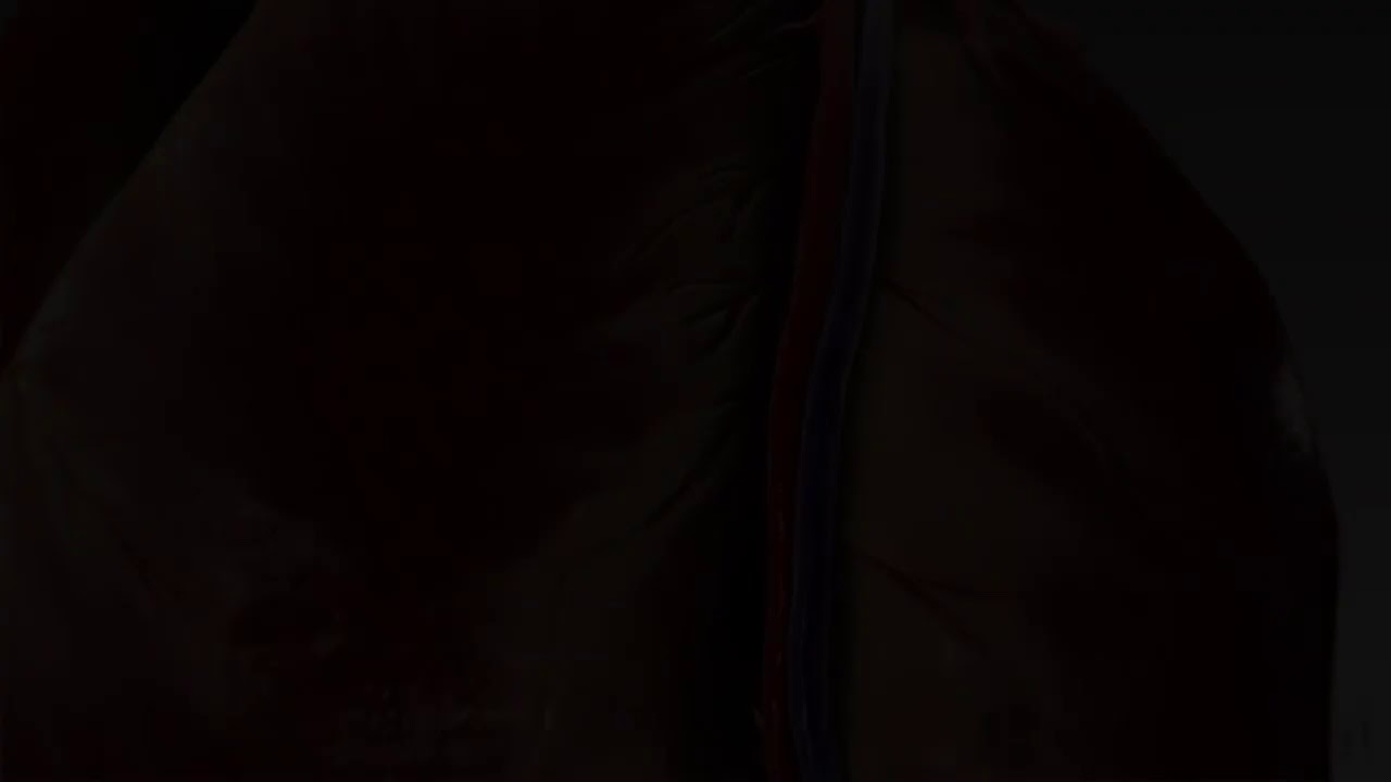 3D Medical Animation What is a Heart Attack n8P3n6GKBSY - YouTube