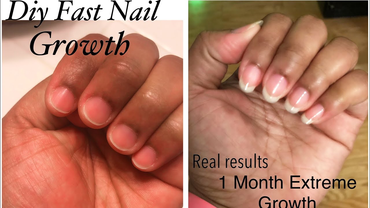 DIY Extreme Nail Growth | Healthy Nails Journey - YouTube
