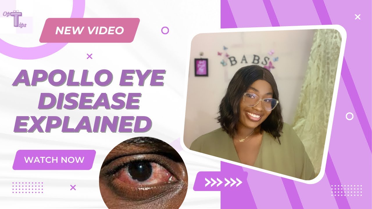 Apollo eye disease explained with prevention | optometry - YouTube
