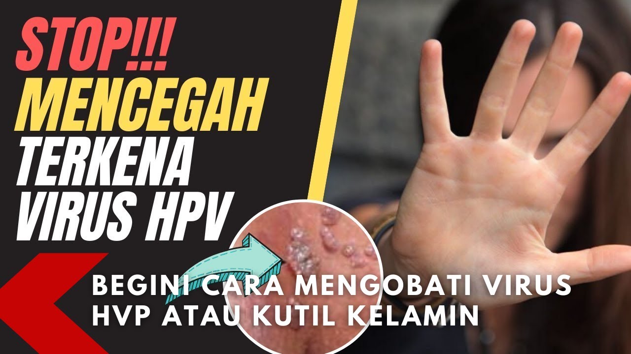 Pengobatan Infeksi HPV ( Human Papiloma Virus) || Kutil Kelamin - YouTube