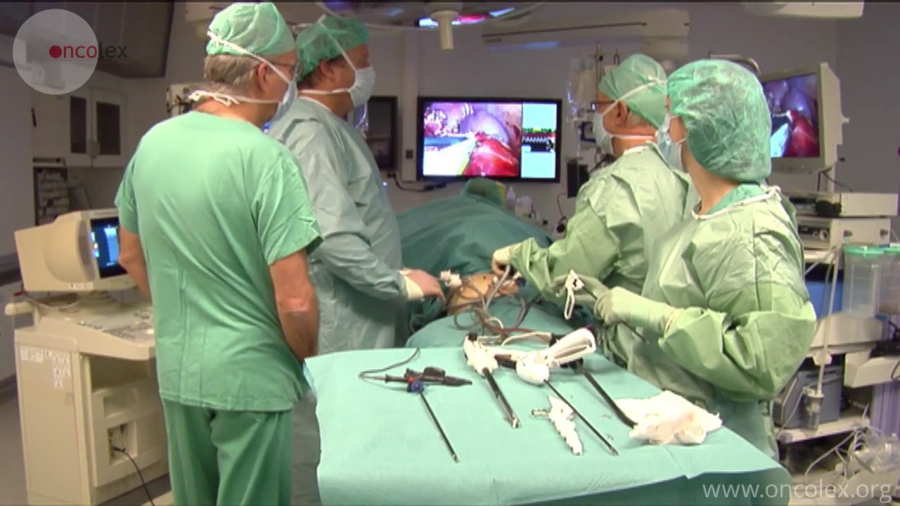 Liver Resection Laparoscopic Removal Of Liver Segments 2 And 3 Youtube