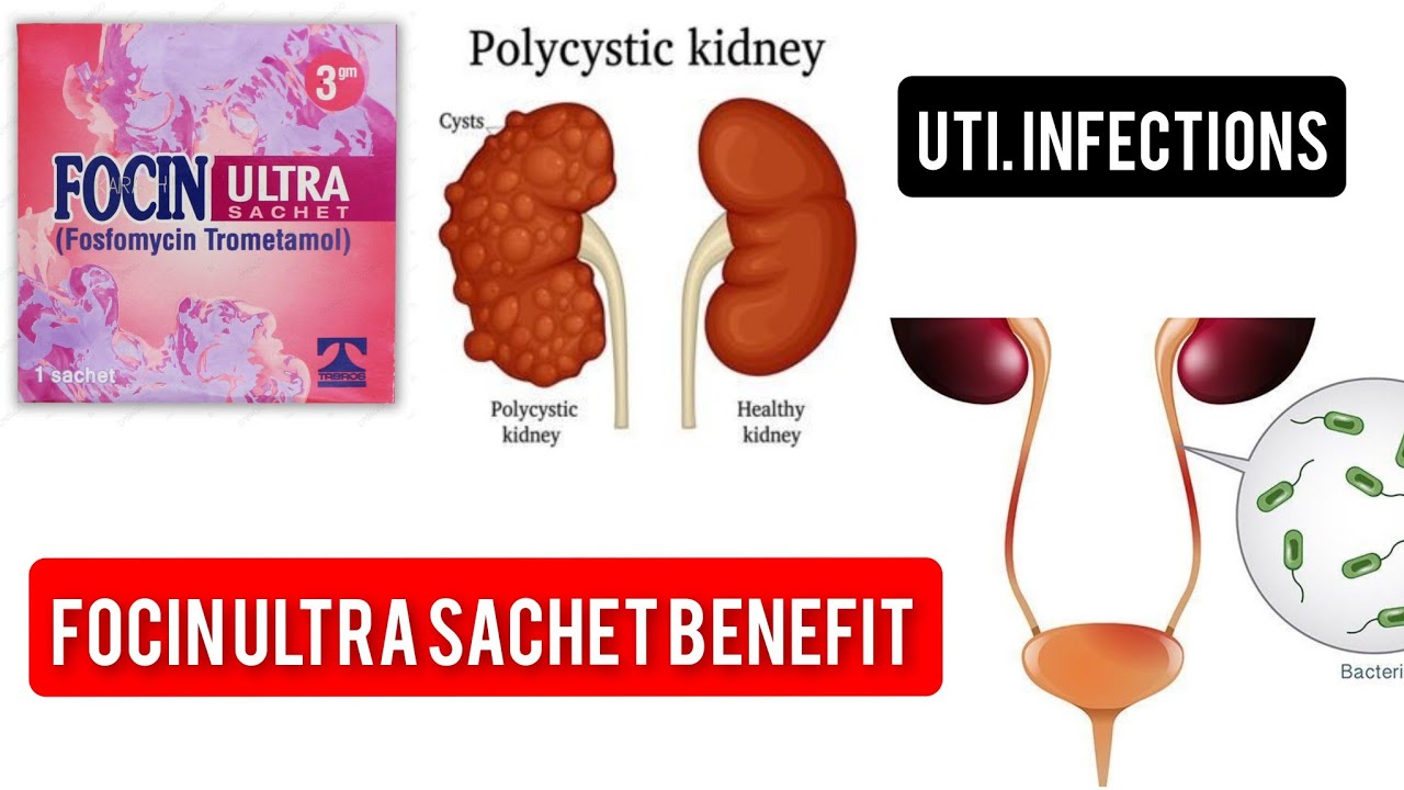How to use/ Focin ultra sachet benefit - YouTube