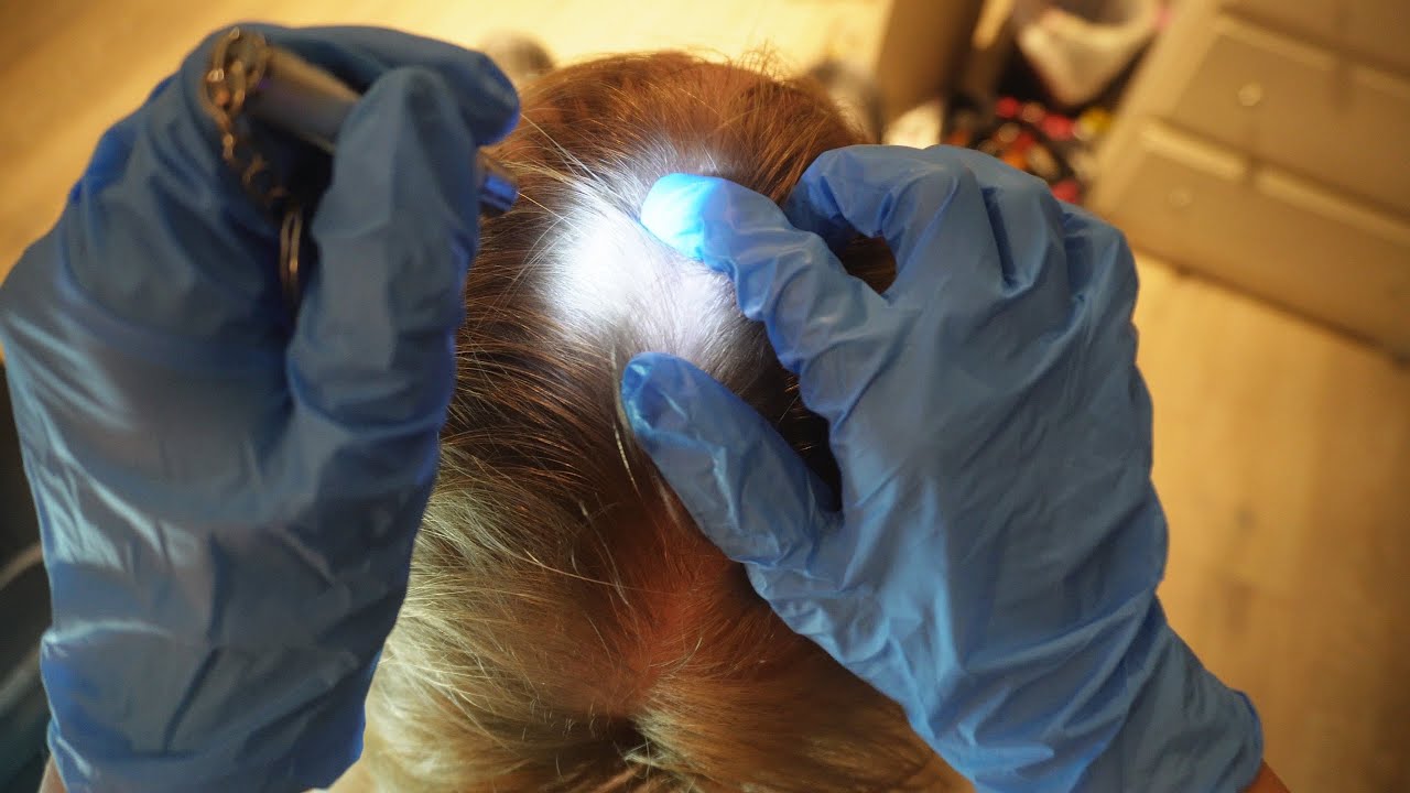 [ASMR] Detailed Scalp Inspection - YouTube