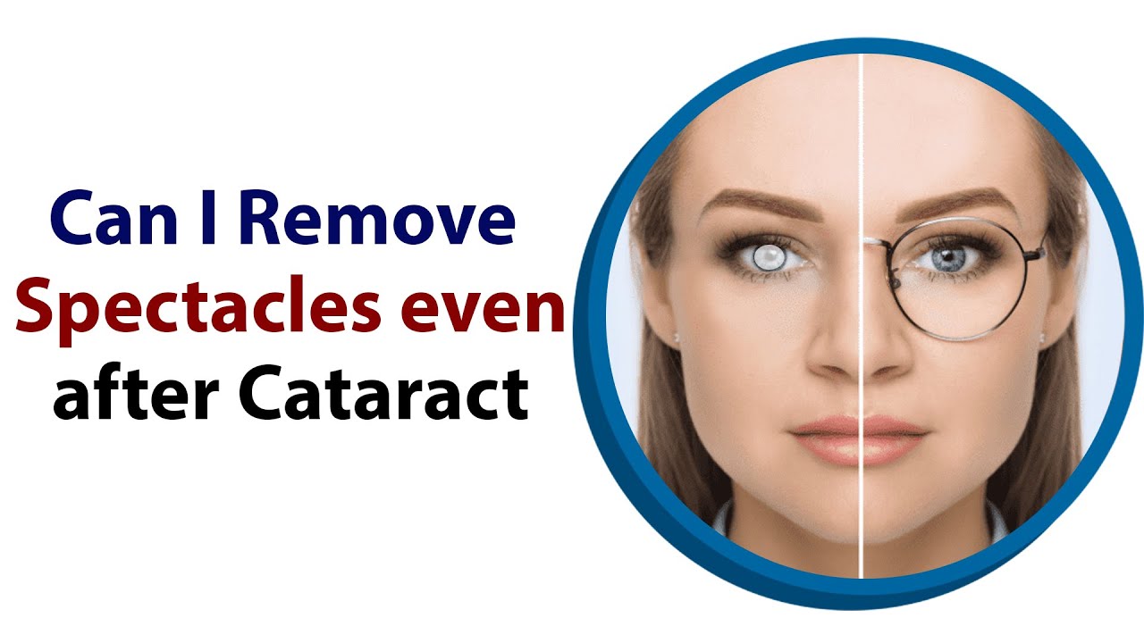 Can I remove spectacles even after cataract ? Dr. Harpreet Eye Dental ...
