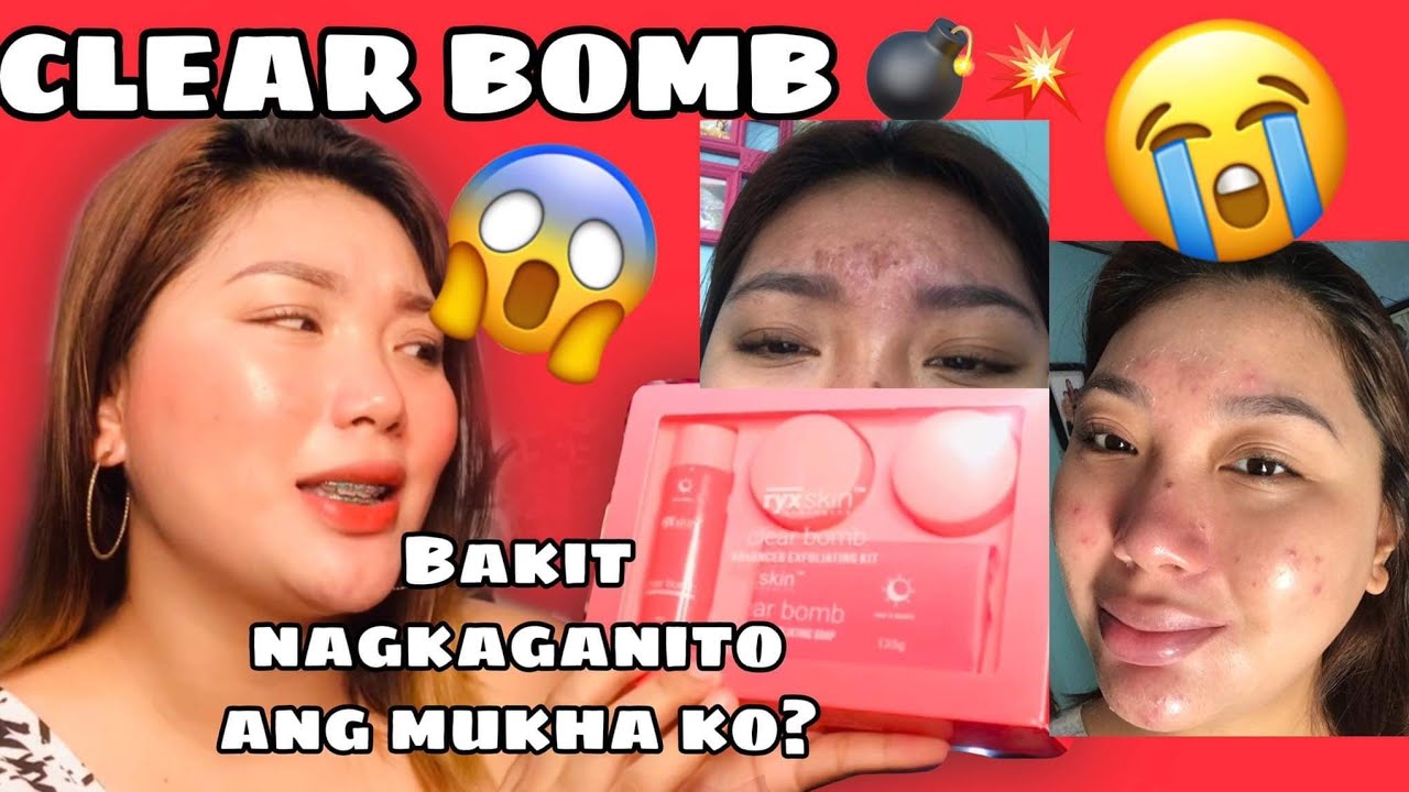 CLEAR BOMB REVIEW | NASUNOG ANG FACE KO? - YouTube