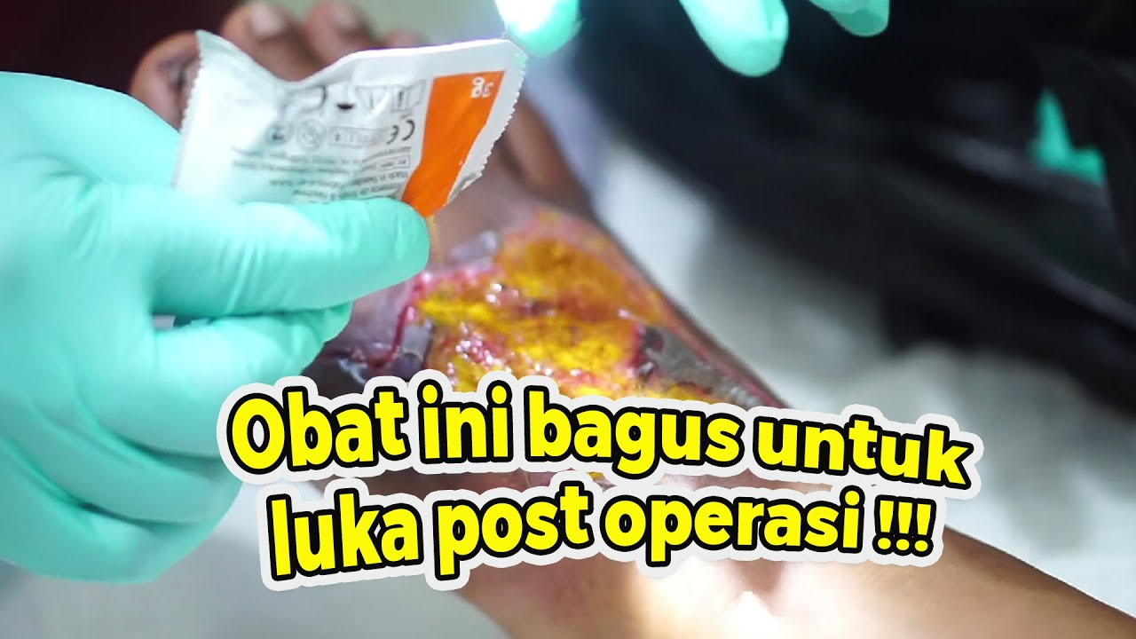 Obat ini bagus untuk luka post operasi ll Part 2 - YouTube