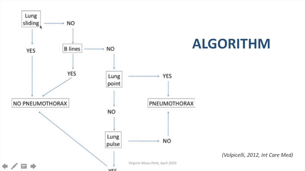 Part 2 Pneumothorax Youtube