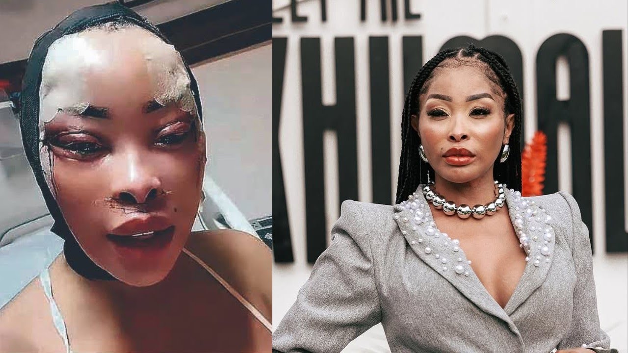 Khanyi Mbau’s Post-Surgery Face Disappoints Mzansi at Meet the Khumalos Premiere! - YouTube