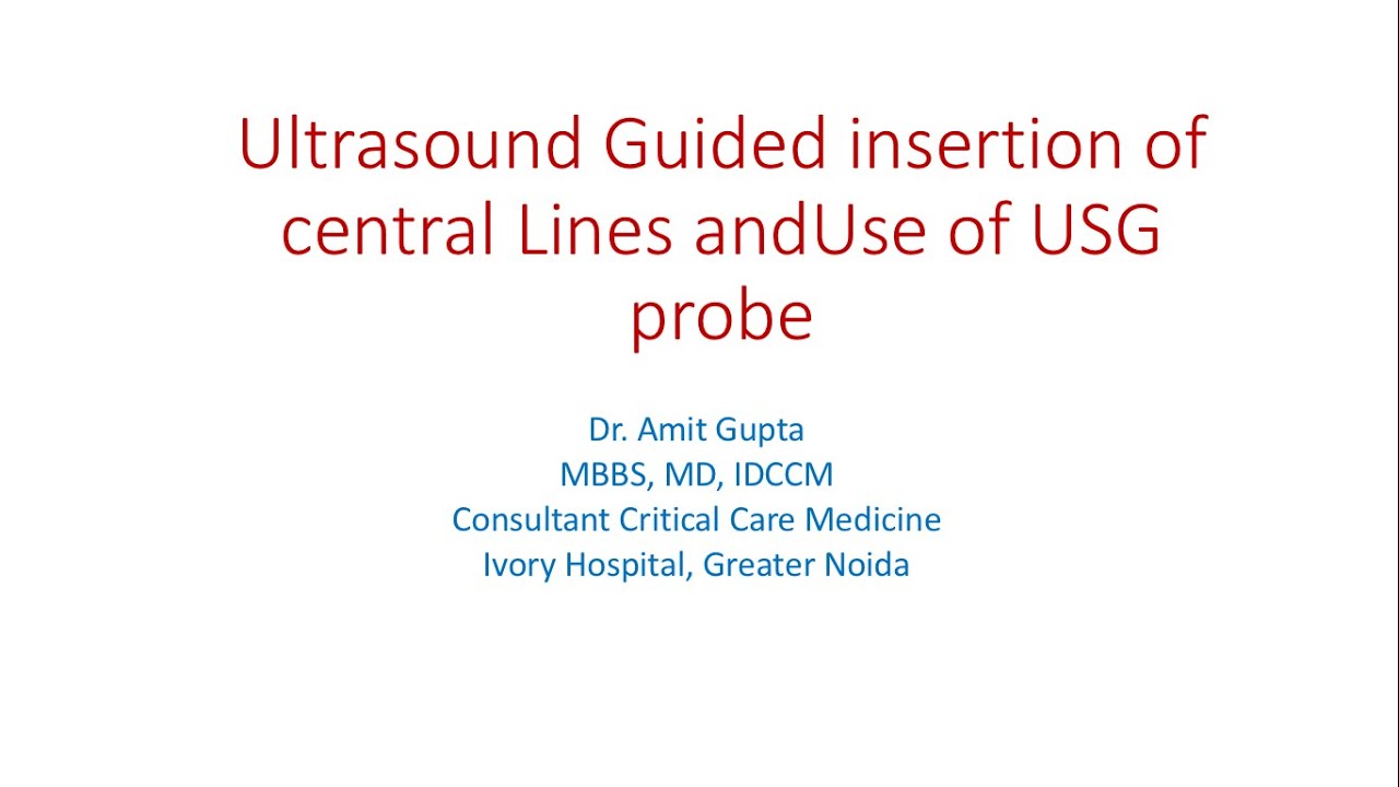 Ultrasound Guided insertion of central lines and Use of USG probe - YouTube