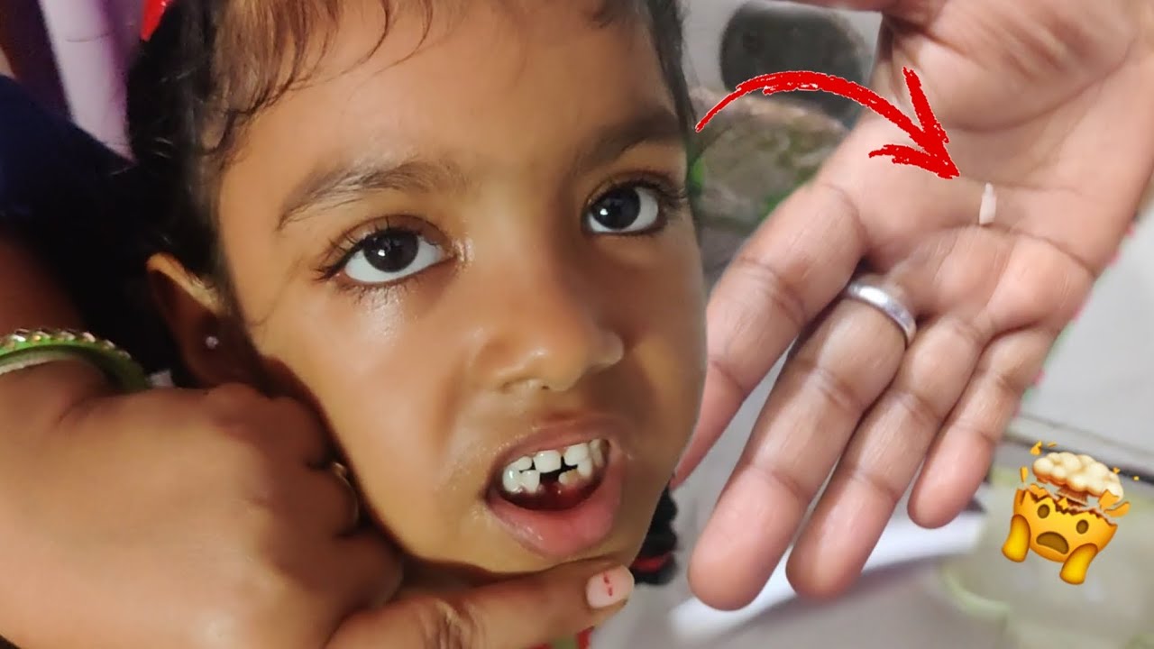 Danth Nikal Diya Behan Ka 😱 Youtube