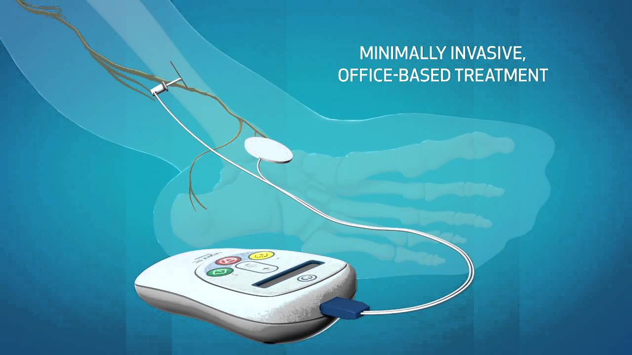 Urgent® PC Animation – How it Works - YouTube