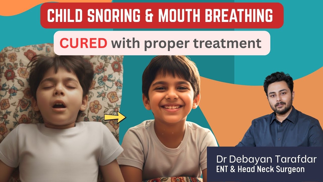 Snoring & Mouth Breathing in Kids | Adenoid & Tonsil Enlargement ...