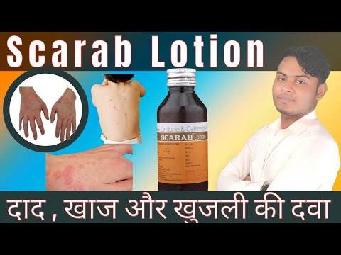 Scarab lotion | Scarab lotion how to apply in hindi | Lindane ...