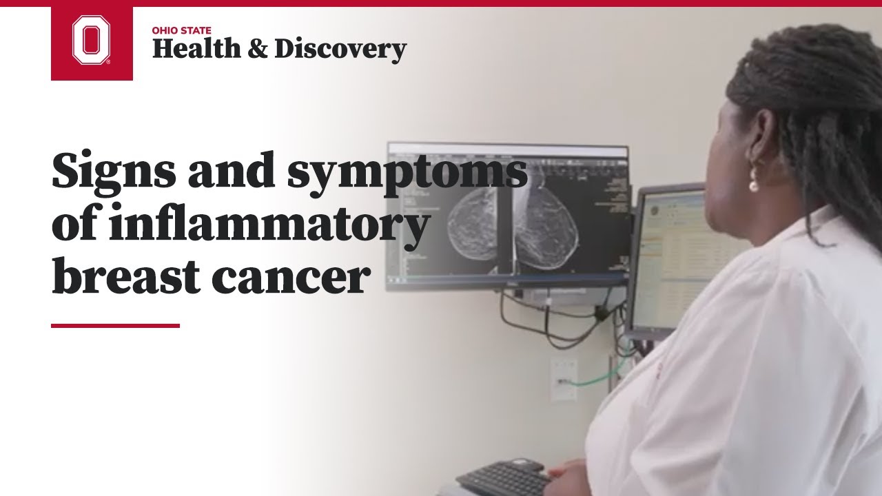 Signs and symptoms of inflammatory breast cancer | Ohio State Medical ...