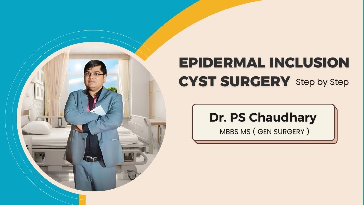 Epidermal Inclusion Cyst Surgery | Step-by-Step Removal Procedure by ...