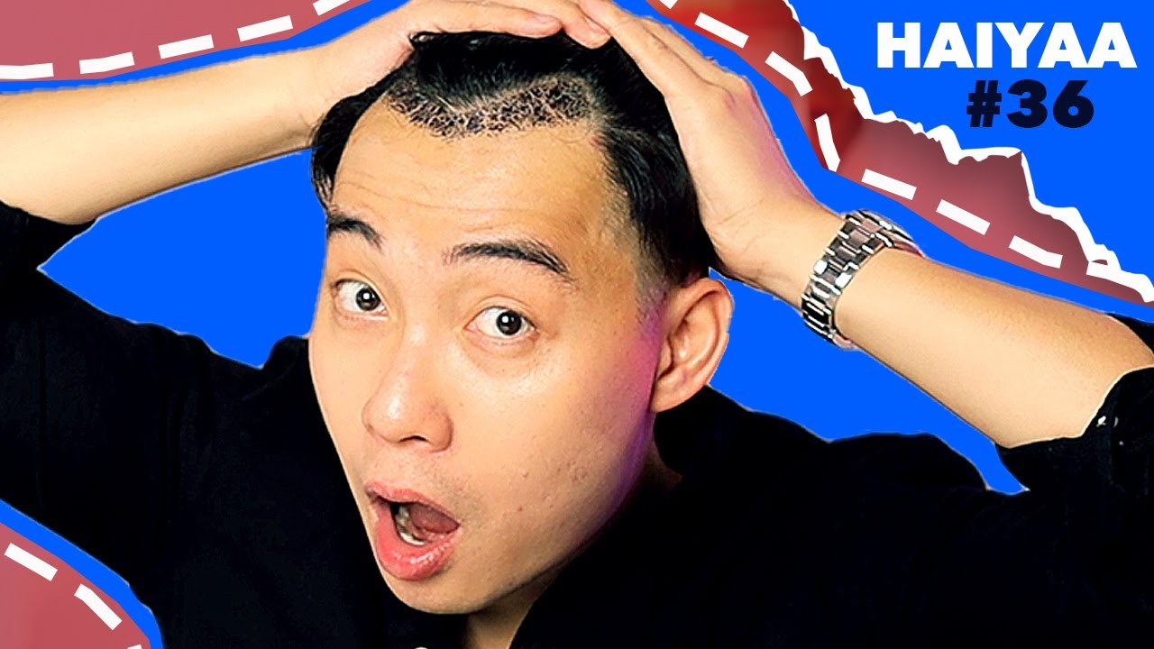 Nigel Got A Hair Transplant! | HAIYAA #36 - YouTube