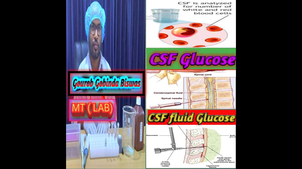 Chemical examination of cerebrospinal fluid. CSF Glucose test in Bangla ...