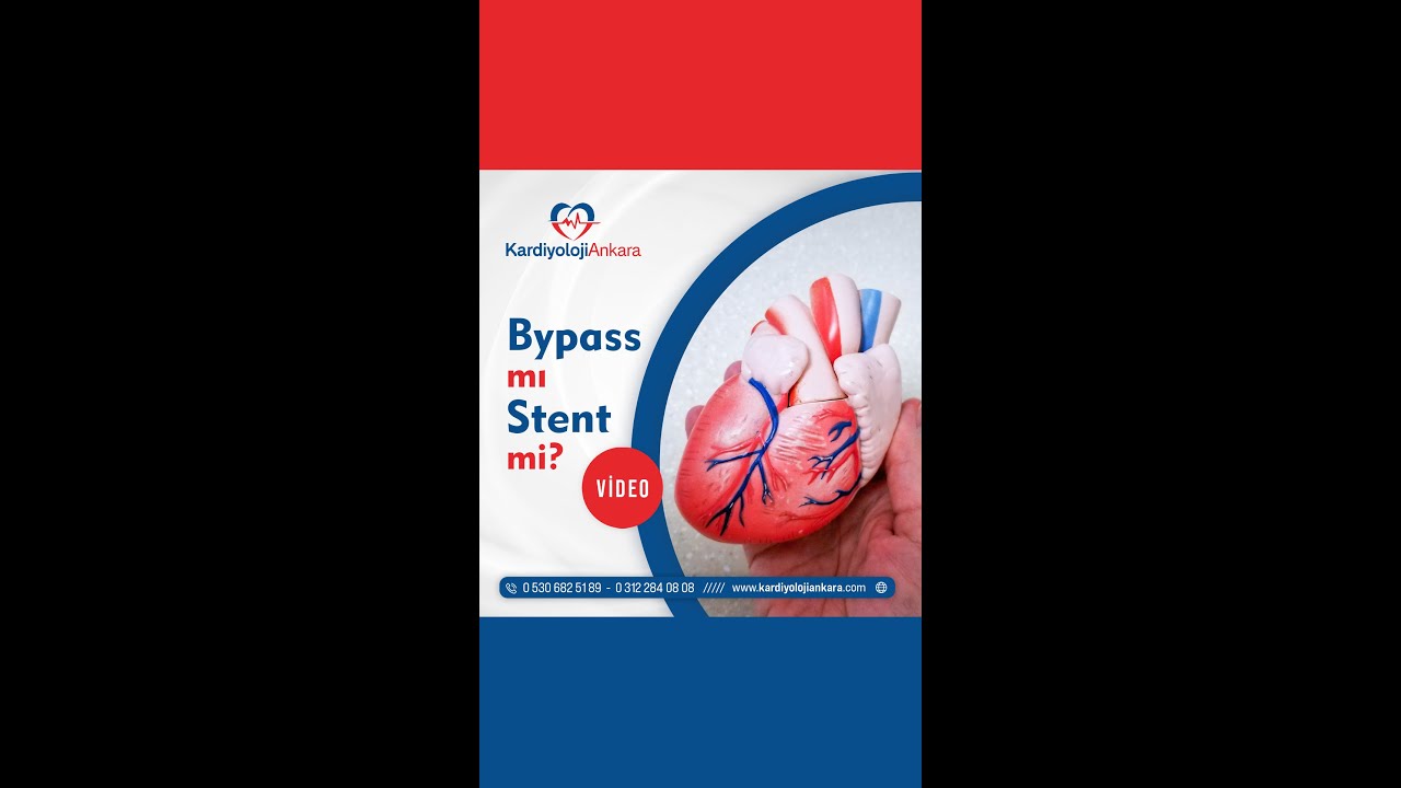 Bypass mı? Stent mi? #kardiyoloji #bypass #stent #anjiyo - YouTube