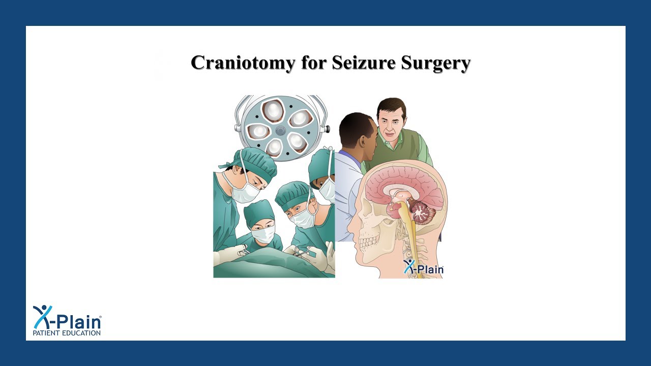 Craniotomy for Seizure Surgery - YouTube