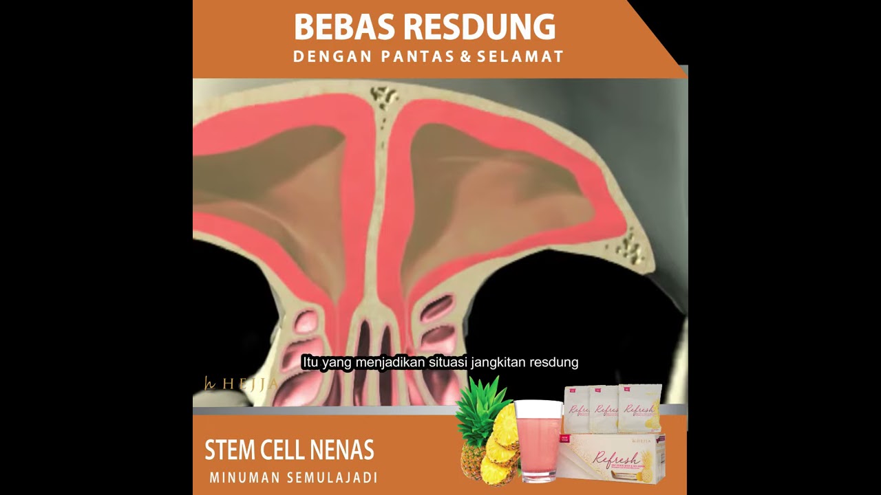 Punca Resdung, Hidung Tersumbat dan Bersin2 - YouTube