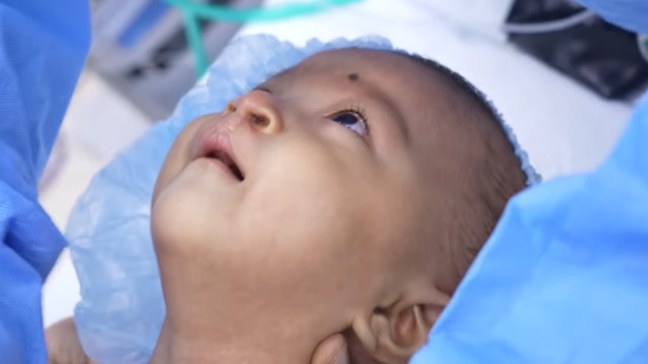 Cute Baby Crying Before Palate Surgery | Anesthesia Video - YouTube