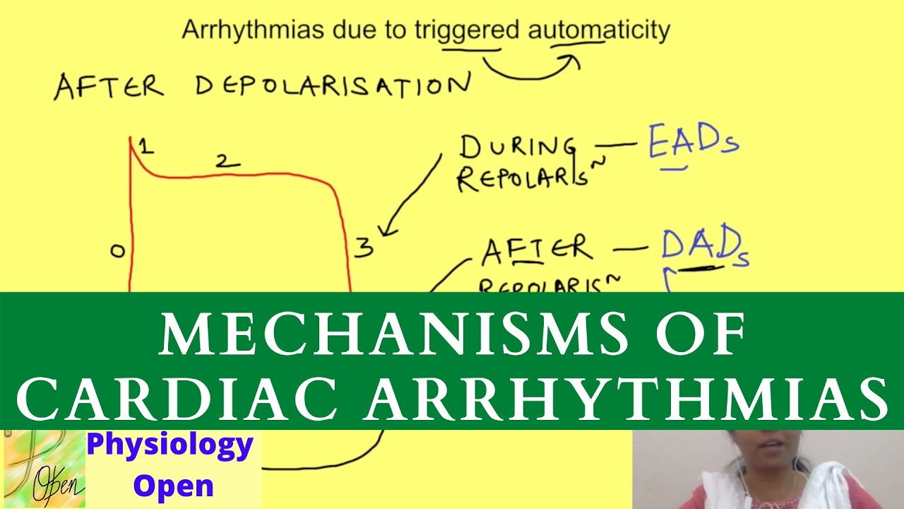 Mechanisms of cardiac arrhythmias | Tachyarrhythmias | Cardiovascular ...