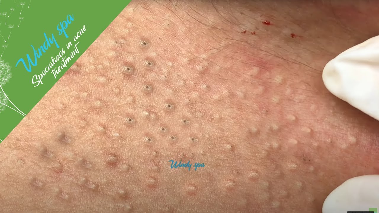 Make Your Day Relaxing with Windy Spa 6#44 - YouTube