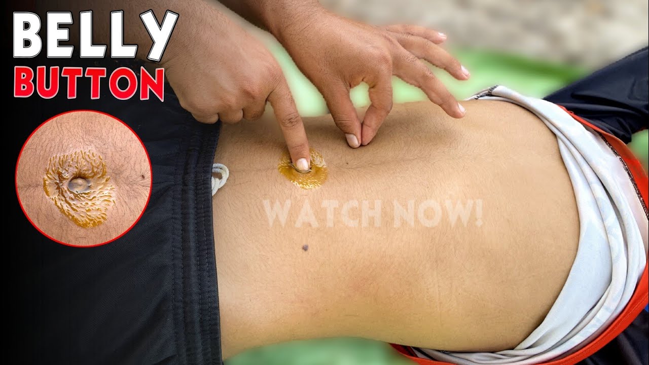 Asmr Belly Button Massage That Will Give You Extreme Sleep In Minutes Youtube