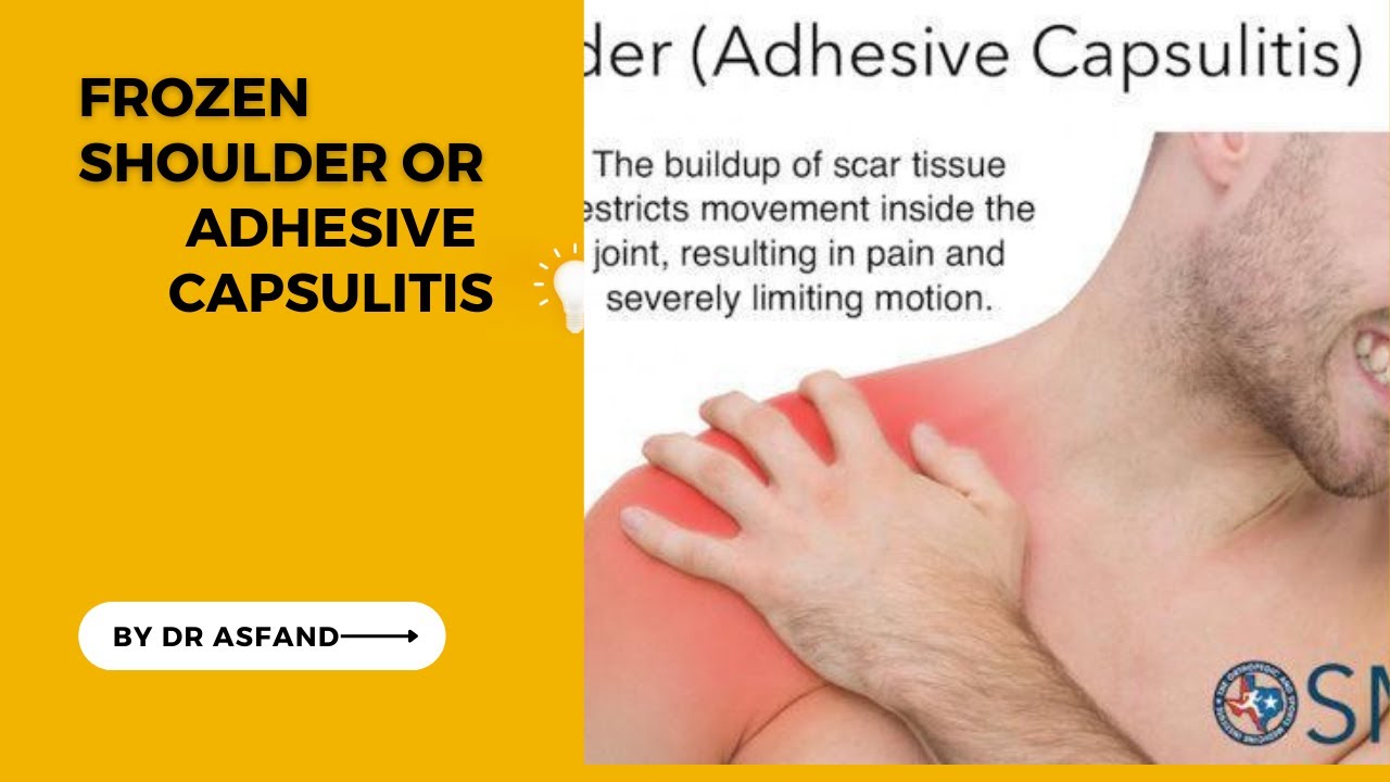 Frozen Shoulder (Adhesive Capsulitis) Lecture / OPD Case Presentation ...
