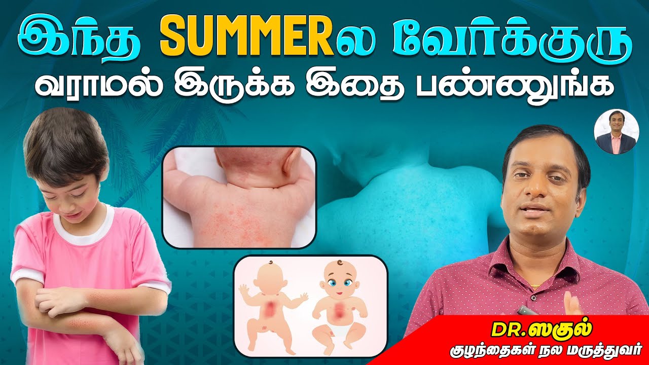 இந்த summer-ல வேர்க்குரு வராமல் இருக்க இதை பண்ணுங்க | Dr Sagul's ...