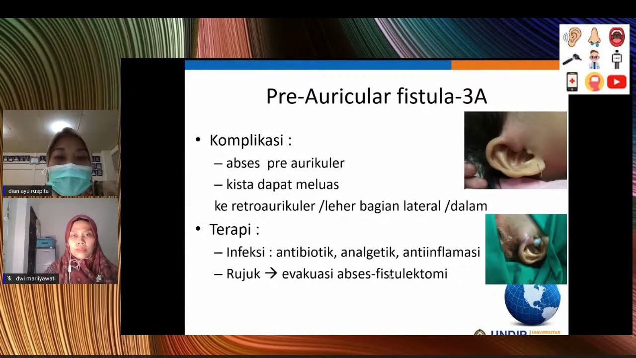 Kelainan Kongenital Telinga Luar - YouTube