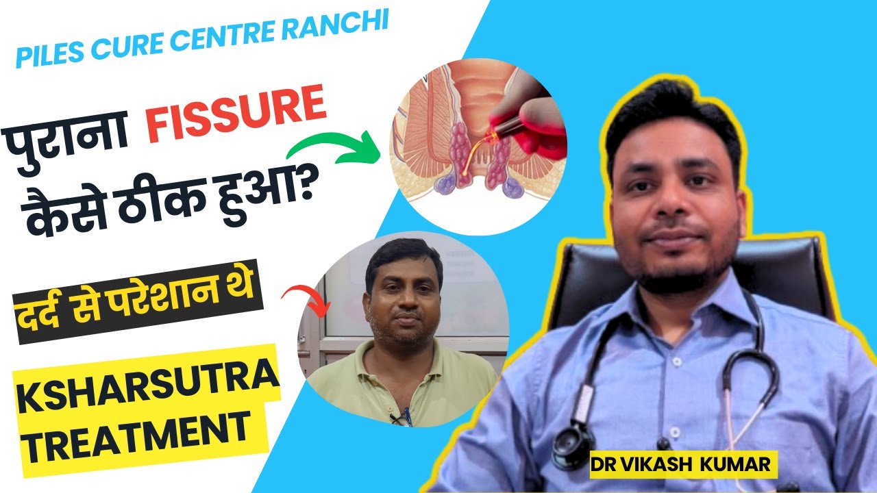 Fissure covert fistulas Ksharsutra treatment in ranchi/Dr Vikash Kumar / Piles Cure Center ...