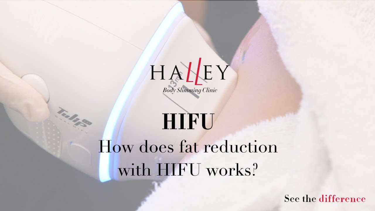 HIFU: How does fat reduction with HIFU works? - YouTube