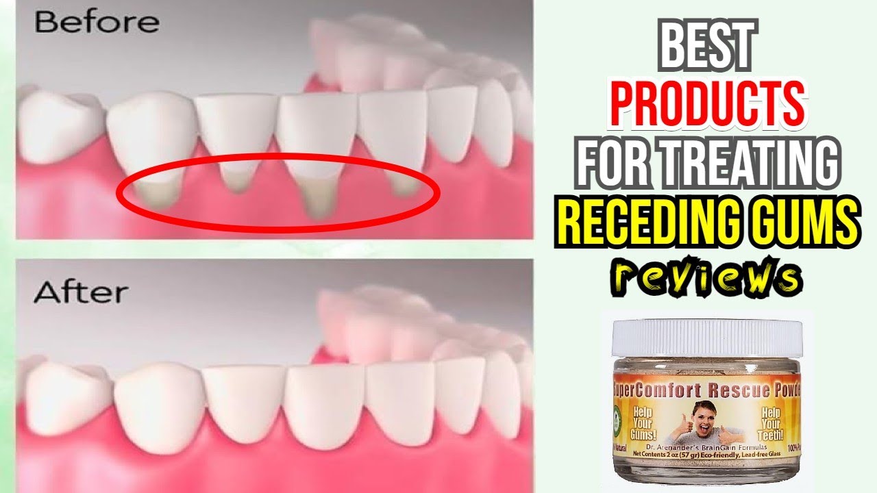 🌿 Revolutionize Your Gum Health: Top 3 Amazon Finds for Receding Gums ...