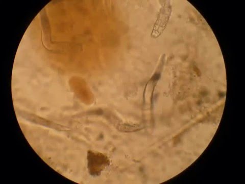 Demodex mite in cat ear.avi - YouTube