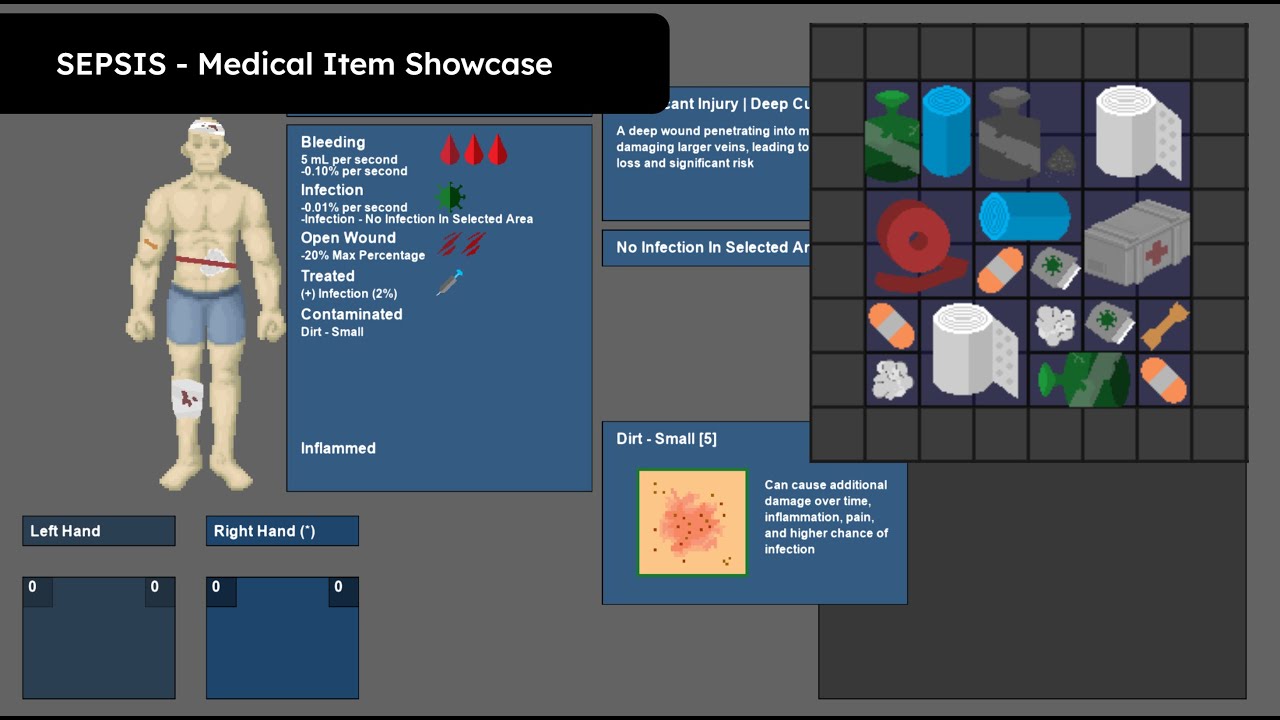 SEPSIS - Medical Items Showcase - YouTube